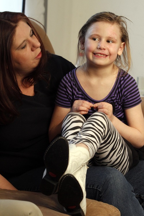 Siblings hit by car have long road to recovery - The Salt Lake Tribune