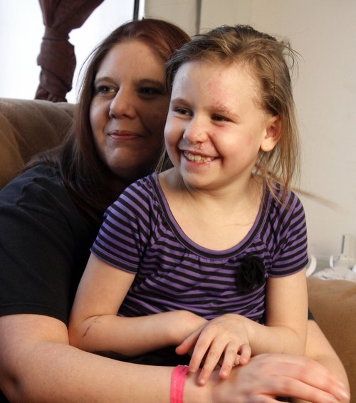 Siblings hit by car have long road to recovery - The Salt Lake Tribune